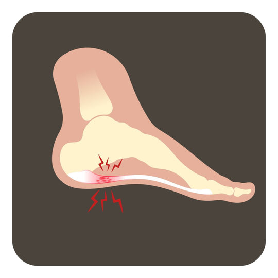 Common Foot & Lower Limb Conditions | Education – The Foot Collective US